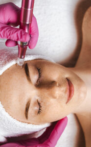 Dermapen NYC, Dermapen Injections In Commack New York - James Christian ...